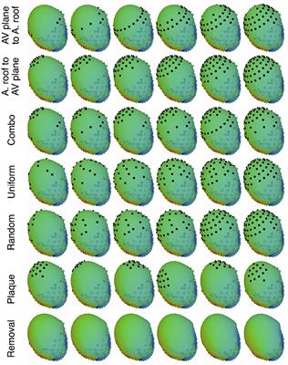 Frontiers | Reducing Error in ECG Forward Simulations With Improved Source Sampling